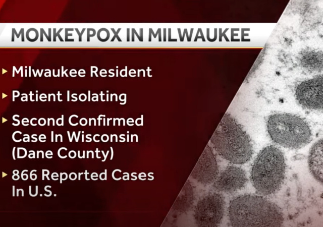 Monkeypox Cases Popping Out Across the Country
