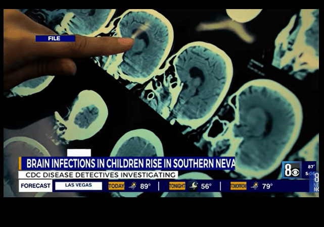 Mysterious Outbreak of Brain Infections Hitting Children in Nevada ...