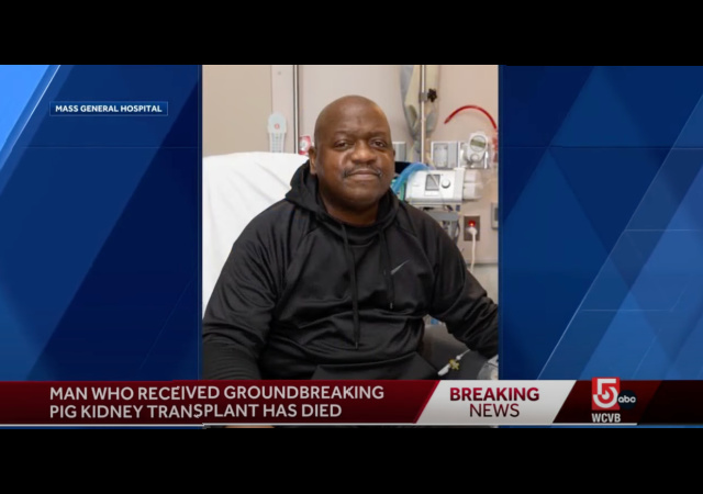 First Recipient of a Genetically Modified Pig Kidney Transplant Dies 8 ...